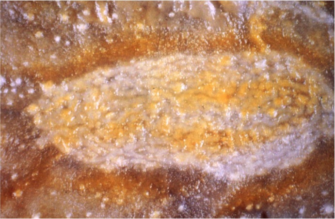 El sistema inmune de las mucosas | El Probiótico